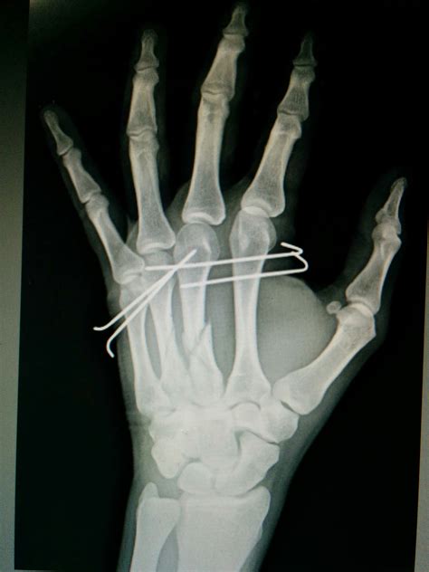 Picorico Hackaday Io