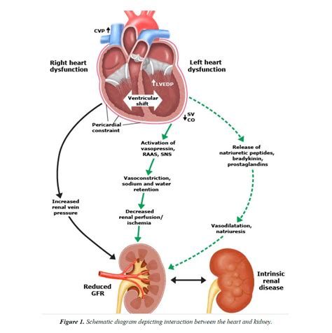 Cardio Renal Syndrome