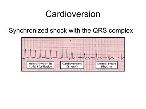 Lecture 3 Cardiac Rhythms Ppt