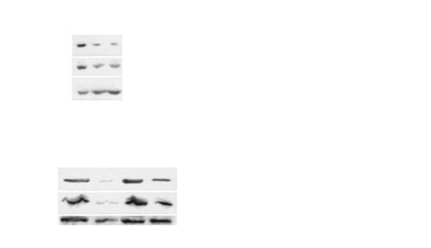 The Decrease In C Src Expression Correlates With A Decrease In Bcl X L Download Scientific