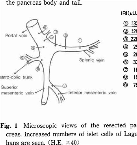 Ptc Step Up Of Iri Was Recognized In Download Scientific Diagram