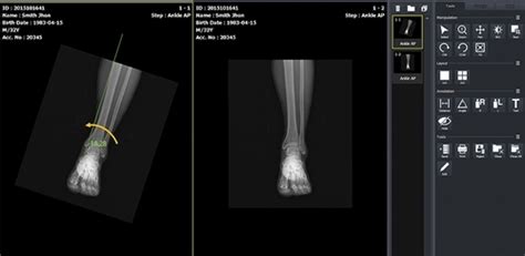 Vxvue Digital X Ray Company