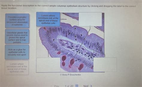 Solved Apply The Functional Description To The Correct Simple Columnar Epithelium Structure By