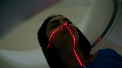 Cryptogenic Stroke Causes Symptoms Treatments And More