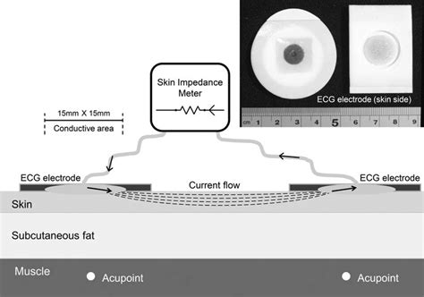 Mismatch Of Electrocardiogram Ecg Electrodes And Acupoints The Ecg Download Scientific