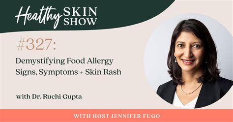 327 Demystifying Food Allergy Signs Symptoms Rashes