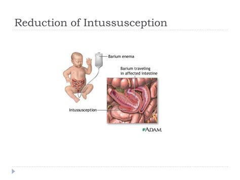 Ppt Gastrointestinal Part Iii Powerpoint Presentation Free Download