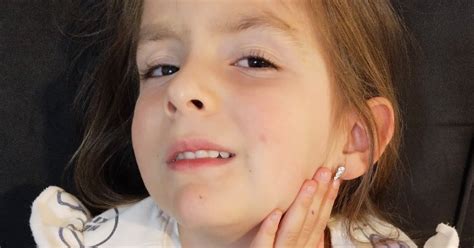 Lo Que Debe Saber Sobre La Amigdalitis Síntomas Riesgos Y