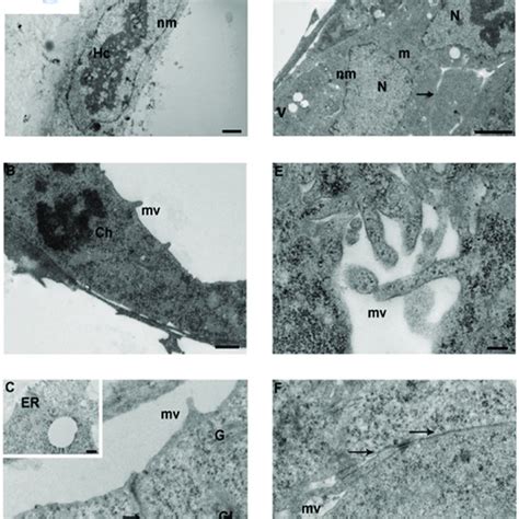 Ultrastructure Of A Control Group Blastocyst A Tem Micrograph Of Te