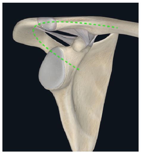 Superior Shoulder Suspensory Complex Download Scientific Diagram
