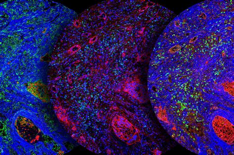 Highly Multiplexed Imaging In Immuno Oncology Science Aaas