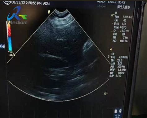 Ge 8c Rs Micro Convex Ultrasound Transducer Probe Cable And Crystal Array Replacement