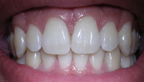Anatomía Dental Noviembre 2015