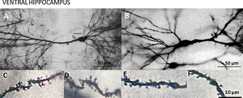 Ventral Hippocampus Representative Photomicrograph Illustrating Download Scientific Diagram