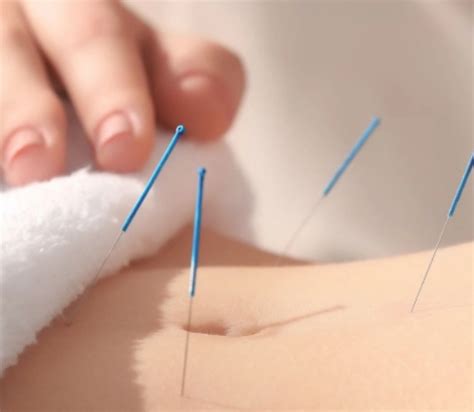 Услуги рефлексотерапевта в Минске цены записаться в медицинский центр «СУПРАМЕД