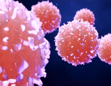 Exploring The Distinct Characteristics Of Nodular Lymphocyte