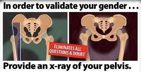 Bench Appearo Forgets That Some Trans People Have Periods R Arethecisok