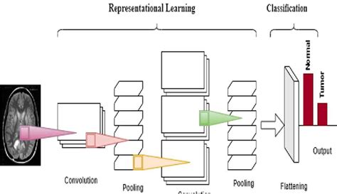 Figure 1 From Deep Learning Based Classification Of Brain Tumors Using