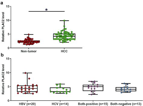 Lncrna Plac2 Accumulation In Hcc Rt Qpcr Results Showed That Lncrna Download Scientific