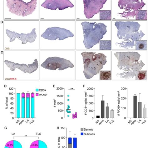 Tertiary Lymphoid Structures Are Present In Hs Skin A Low Power