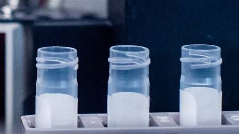 Genetic Testing For Ibd Patients Mayo Clinic Laboratories Posted On