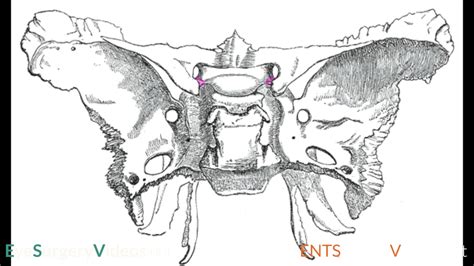 Optic Canal Sphenoid Bone