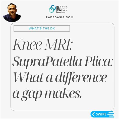 Knee Mri Plica Suprapatellar Bursa Lipohemarthrosis Radedasia