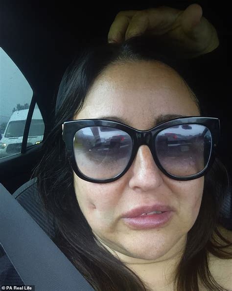 Woman 49 Desperate For Dimples Like Cheryl Reveals She Had Them Surgically Created Daily