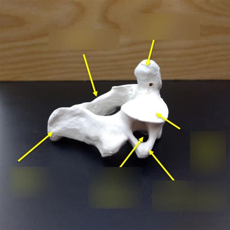 Axis Diagram Quizlet