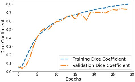 A Unified Pipeline For Simultaneous Brain Tumor Classification And Segmentation Using Fine Tuned