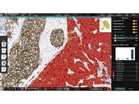 The University Of Leeds An Insight Into Digital Pathology Pathology News