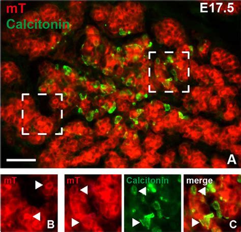 Localization Of Embryonic Thyroid C Cells In Wnt1 Cremtmg Mouse