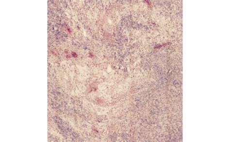 Using Spatial Annotations • Spata2