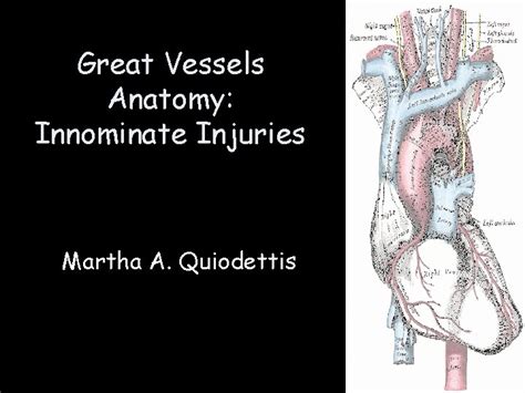 Great Vessels Anatomy Innominate Injuries Martha A Quiodettis