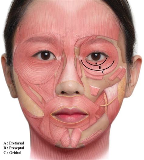What Is Orbicularis Oculi Muscle Oocm Yousef Nazari Md Posted On