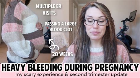 Bleeding In Pregnancy First And Second Trimester Bleeding