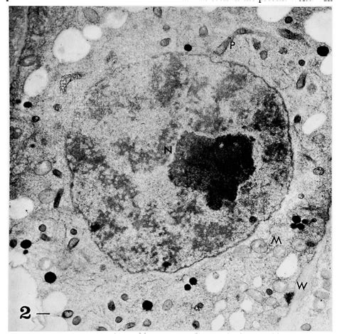 Figure 1 From Electron Microscopy Of Dividing Cellsii Microtubules