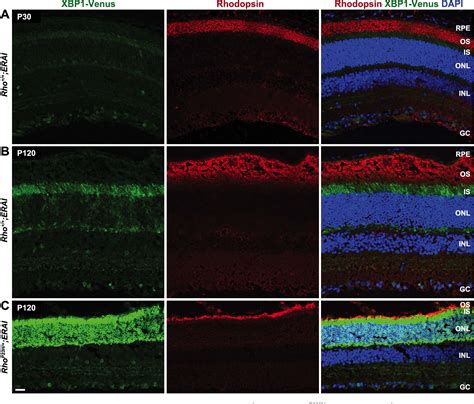 Figure 1 From In Vivo Visualization Of Endoplasmic Reticulum Stress In