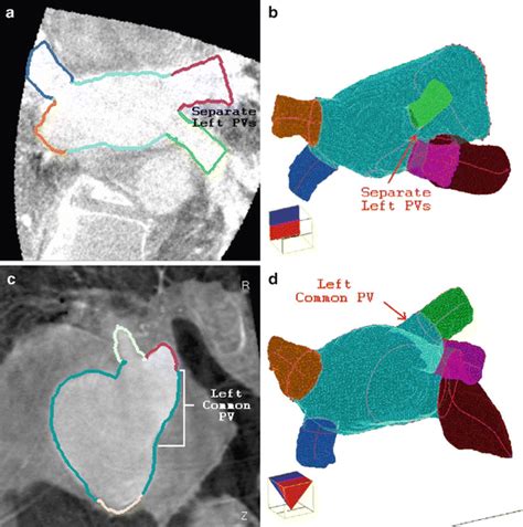 part based object detection and segmentation radiology key