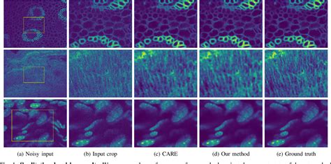 Generalizable Denoising Of Microscopy Images Using Generative Adversarial Networks And