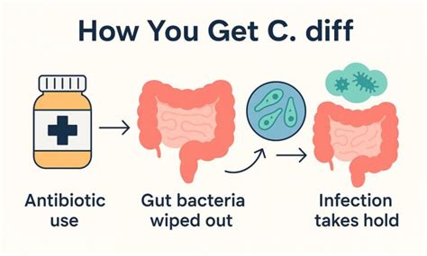 What Is C Diff And How Do You Get It