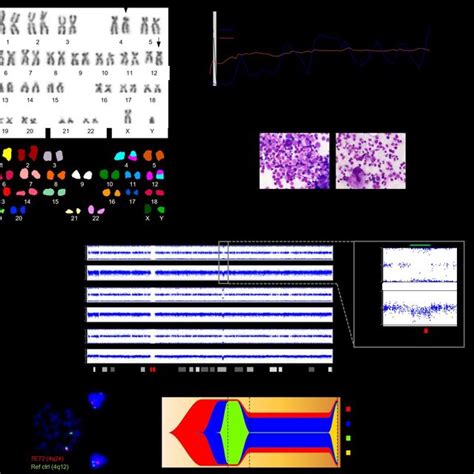 Biallelic TET2 Mutation In A Patient With 5 Aza Sensitive AML A Download Scientific Diagram