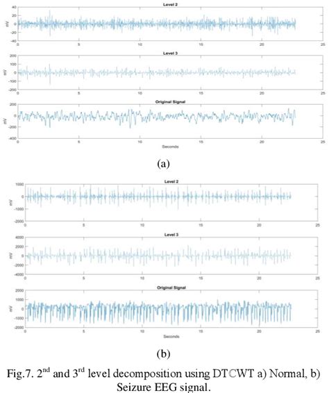Table 1 From Classification Of Eeg Signals In A Seizure Detection