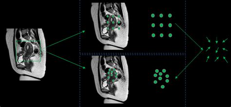 comparison of regular and deformable convolution download scientific