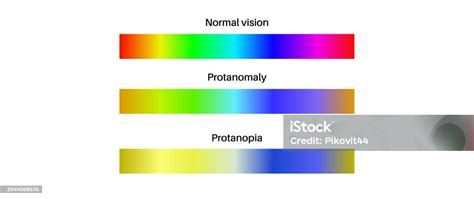 Protanomaly And Protanopia Stock Illustration Download Image Now