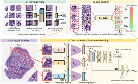 Figure 2 From Cross Scale Multi Instance Learning For Pathological