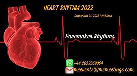understanding pacemaker rhythms ventricular and atrioventricular