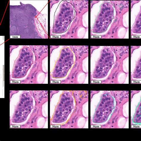 Visualization Of Conventional And Dilated Convolution A Conventional