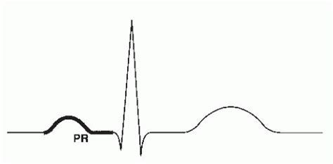 Waveforms Intervals Segments And Complexes Thoracic Key