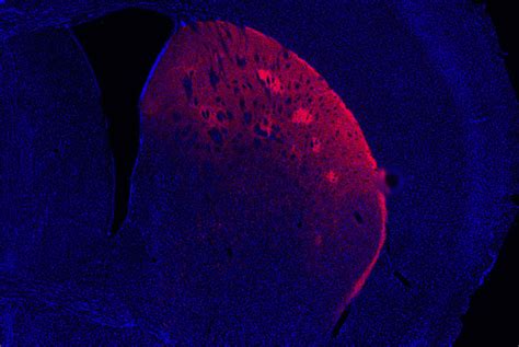 Dopamine Neurons Are More Diverse Than Previously Thought